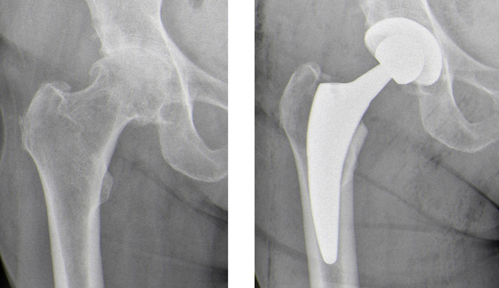 Endoprothetikzentrum für Hüfte und Knie | Krankenhaus Reinbek